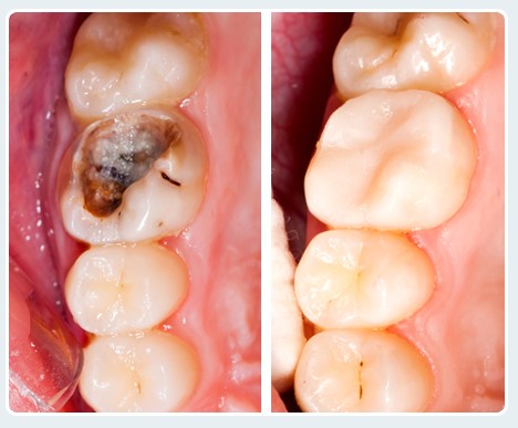 Restorative Dentistry – Munich